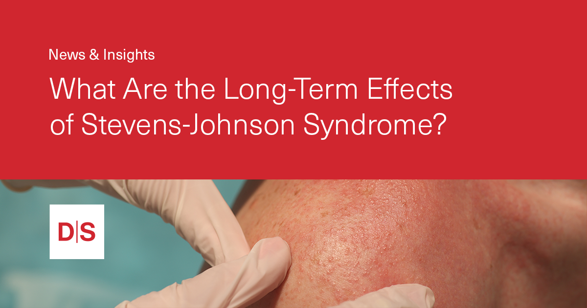 Long-Term Complications of Stevens-Johnson Syndrome | Dunn Sheehan, LLP