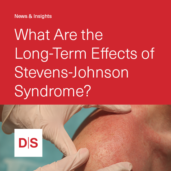 Long-Term Complications of Stevens-Johnson Syndrome | Dunn Sheehan, LLP