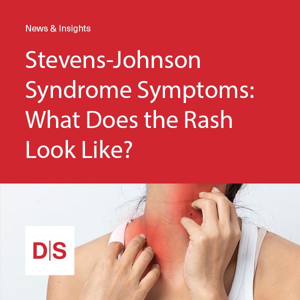 Recognizing Stevens-Johnson Syndrome Symptoms | Dunn Sheehan, LLP